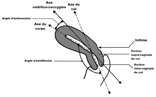 Anteversion/ anteflexion