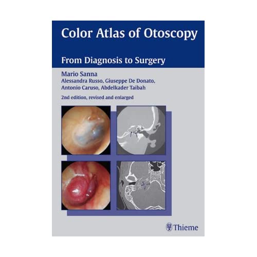 Color atlas of otoscopy, Thieme