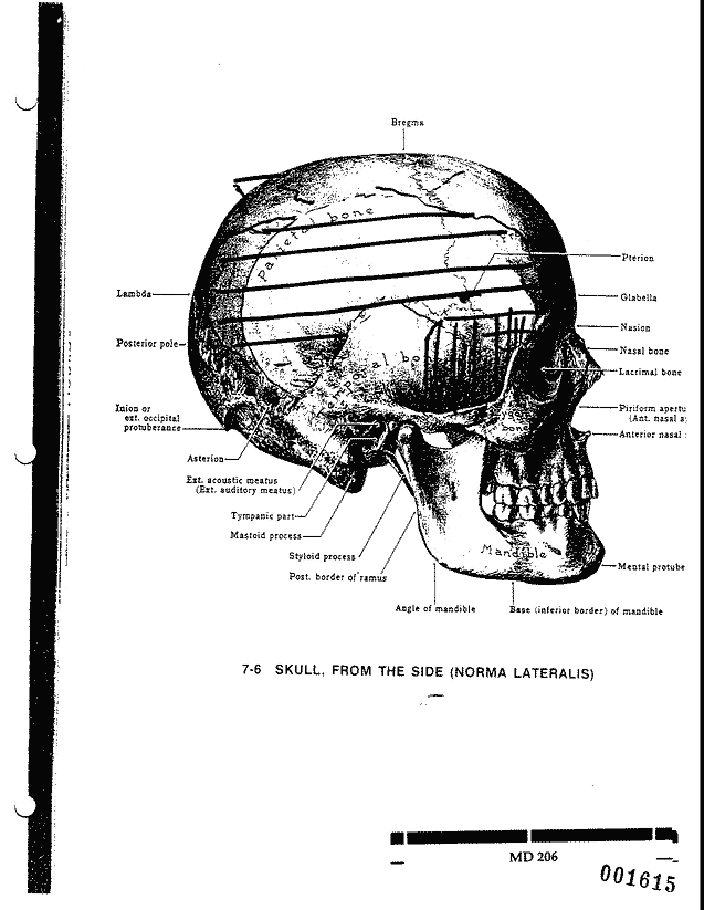 How the Bullet from the Grassy Knoll Caused a Large Wound in the Back ...