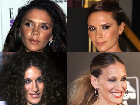 RETOQUES FACIALES Famosas operadas: el antes y el después de las ...